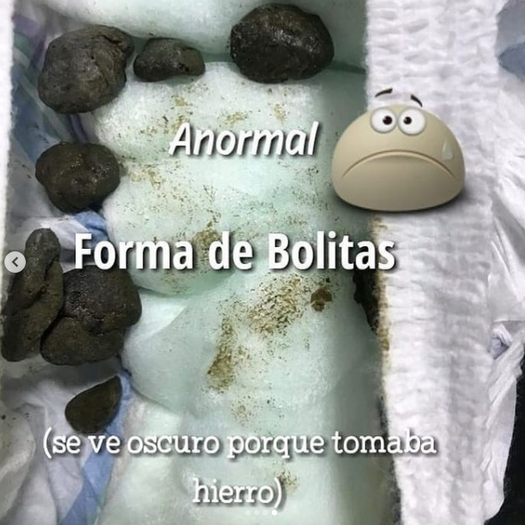 ESTREÑIDO – Dra Michelle Gastro Pediatra